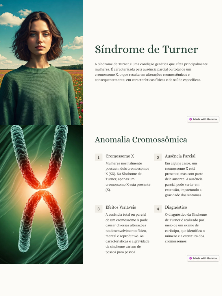 Sindrome de Turner | PDF