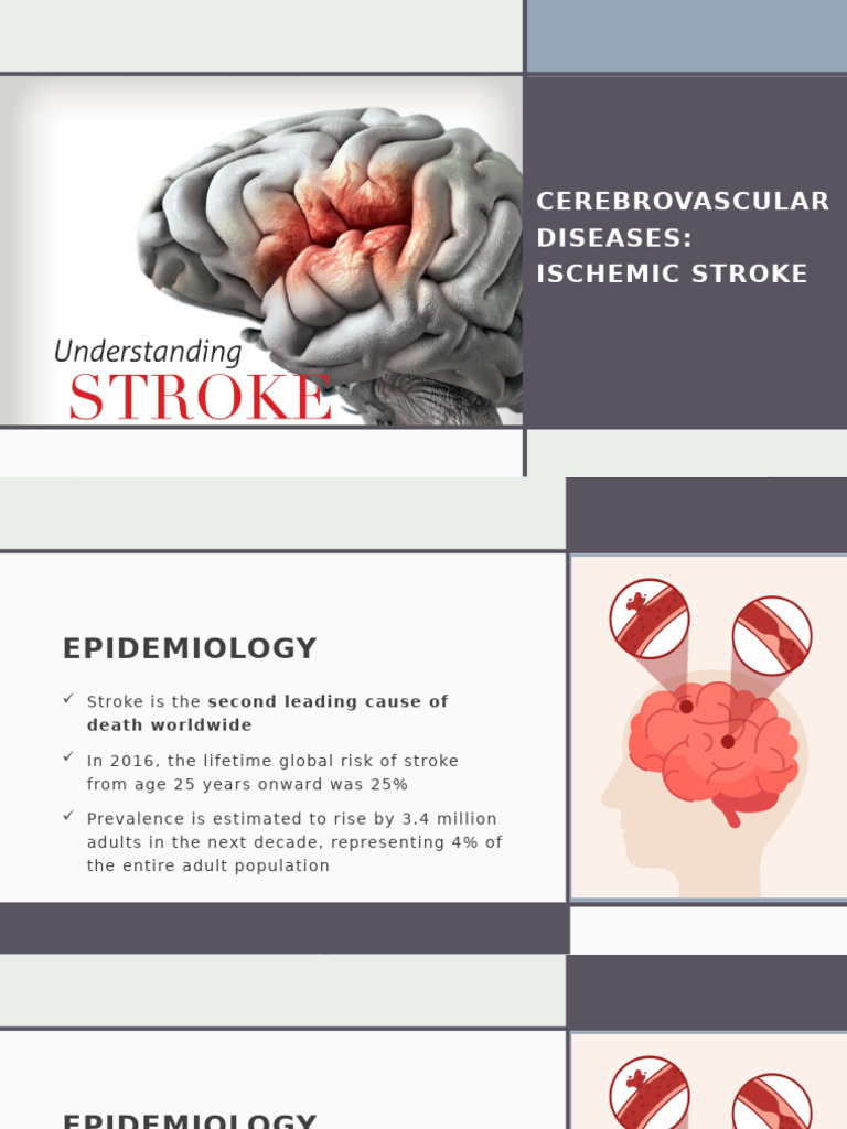 Ischemic Stroke | PDF