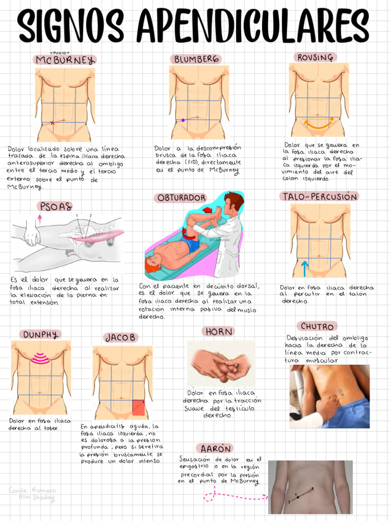Signos Apendiculares y Dolor Fosa Illaca | PDF | Gastroenterología ...