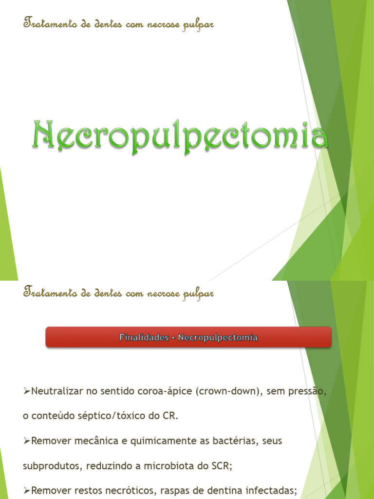 NECROPULPECTOMIA | PDF