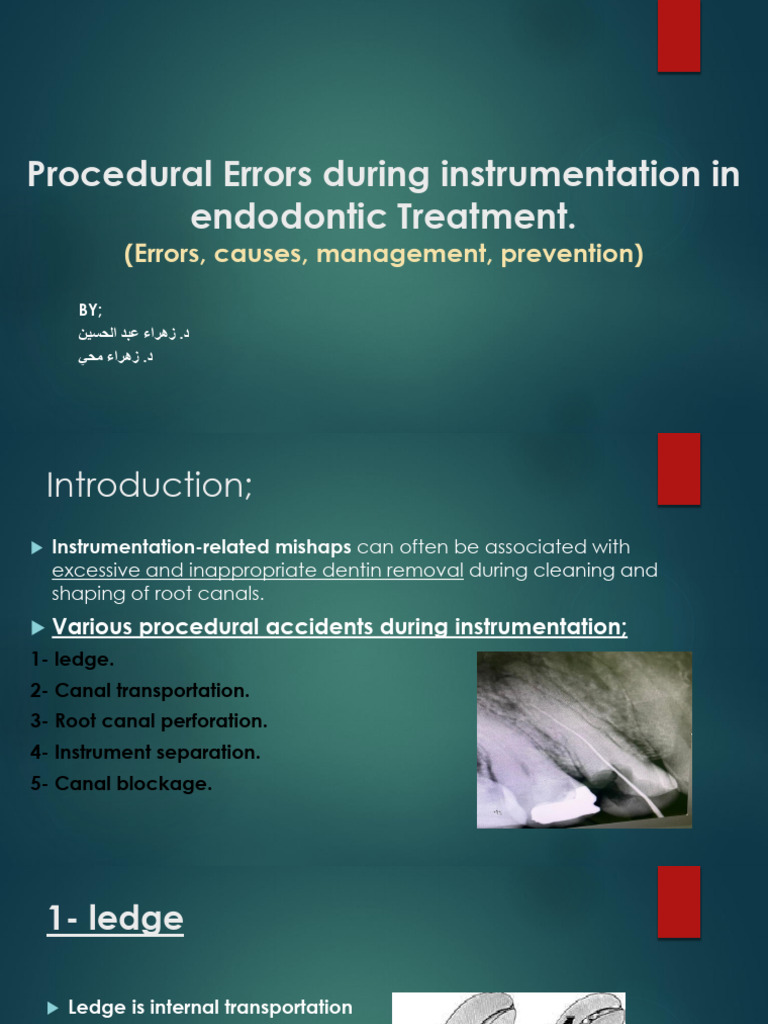 Procedural Errors During Instrumentation in Endodontic Treatment | PDF