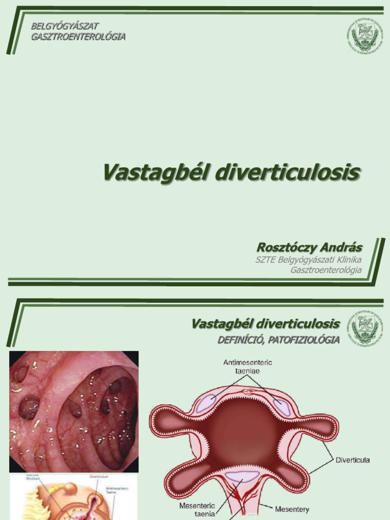 Colon Diverticulosis, Anorectalis Disfunctio-Dr. Rosztóczy A. | PDF
