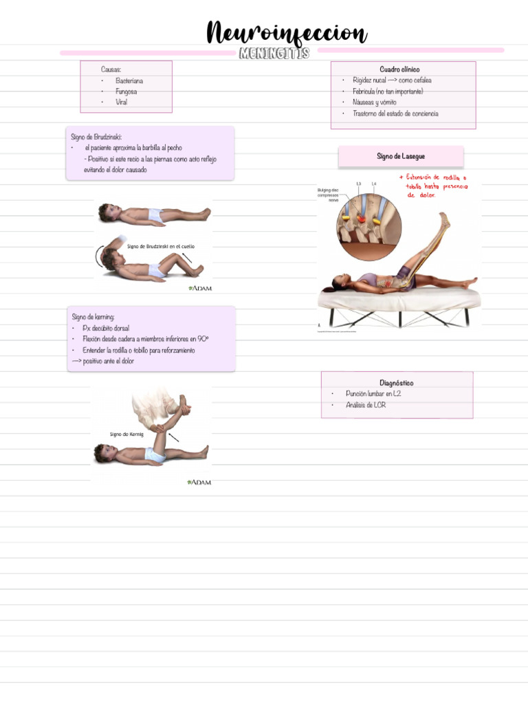 Signos de Meningitis en Pediatría | PDF