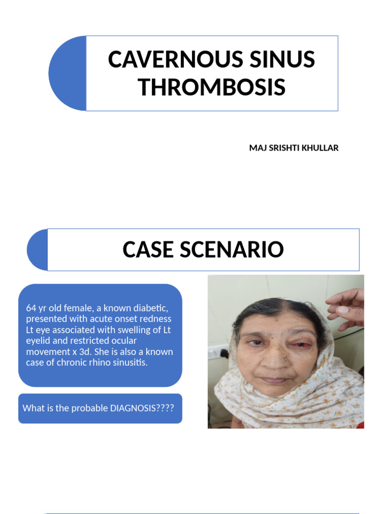 CAVERNOUS Sinus Thrombosis | PDF | Vein | Human Anatomy