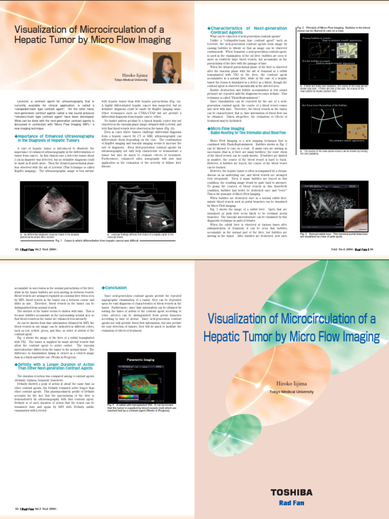 Clinical Article For MFI - MFI | PDF