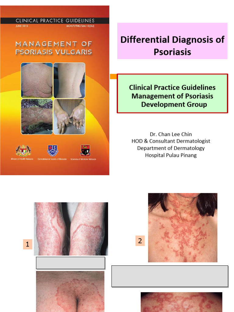 4.differential Diagnosis in Psoriasis | PDF