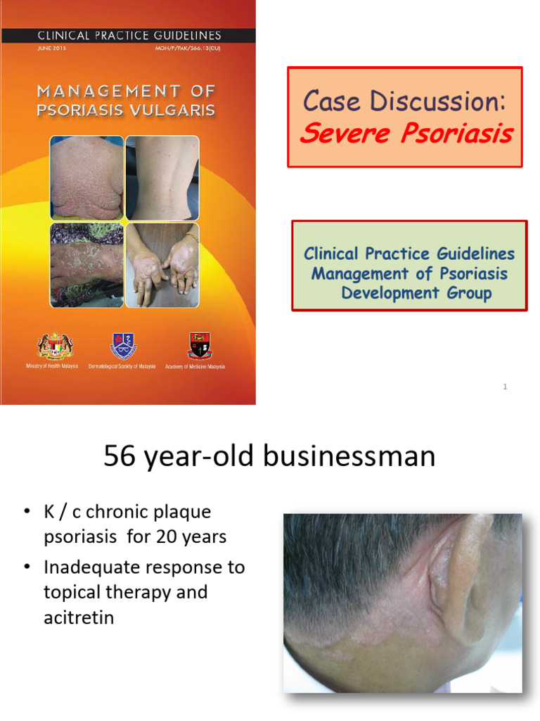 Case Discussion - Severe Psoriasis | PDF