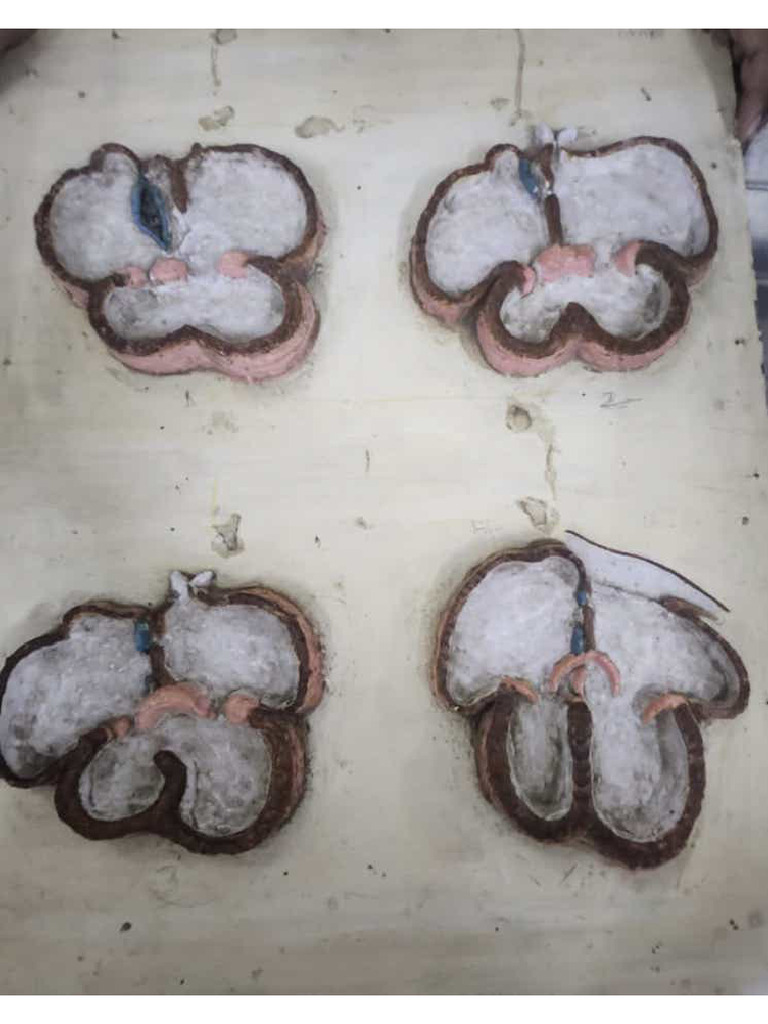 Development of Interatrial Septum Embryo Models | PDF