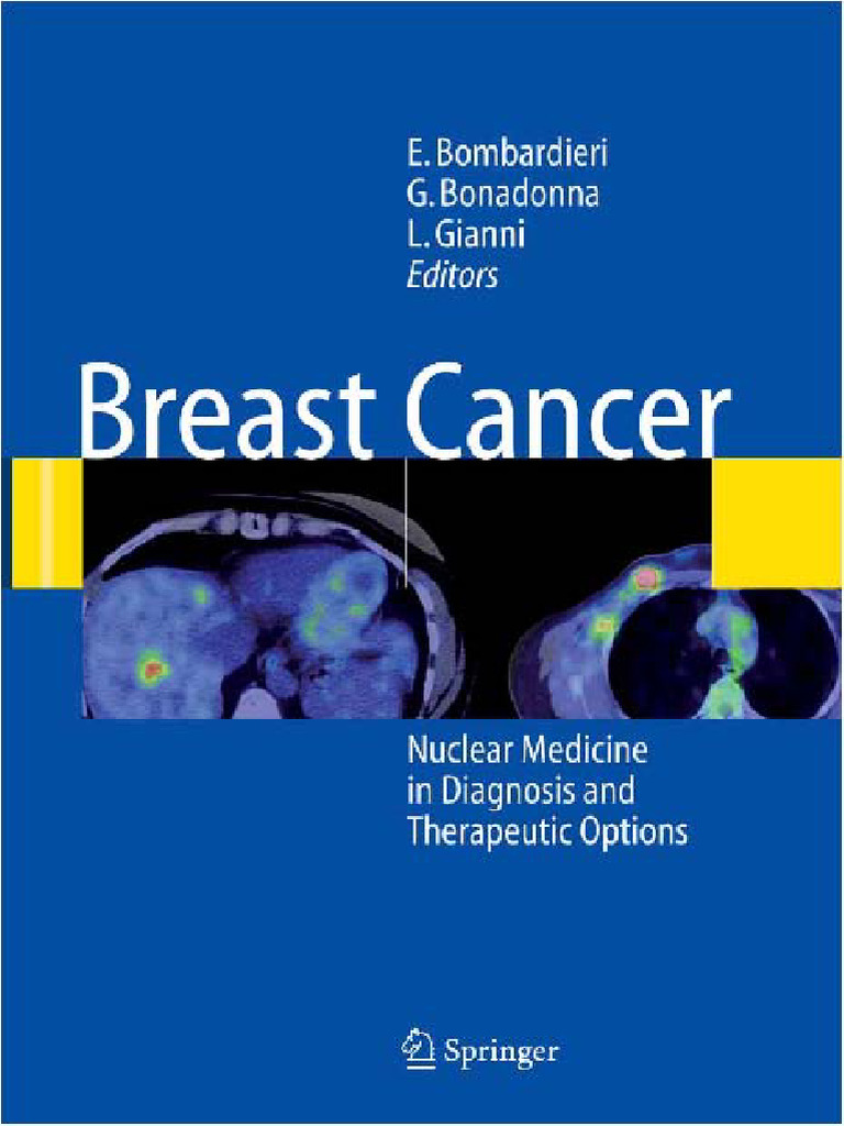 Breast Cancer Nuclear Medicine in Diagnosis and Therapeutics | PDF