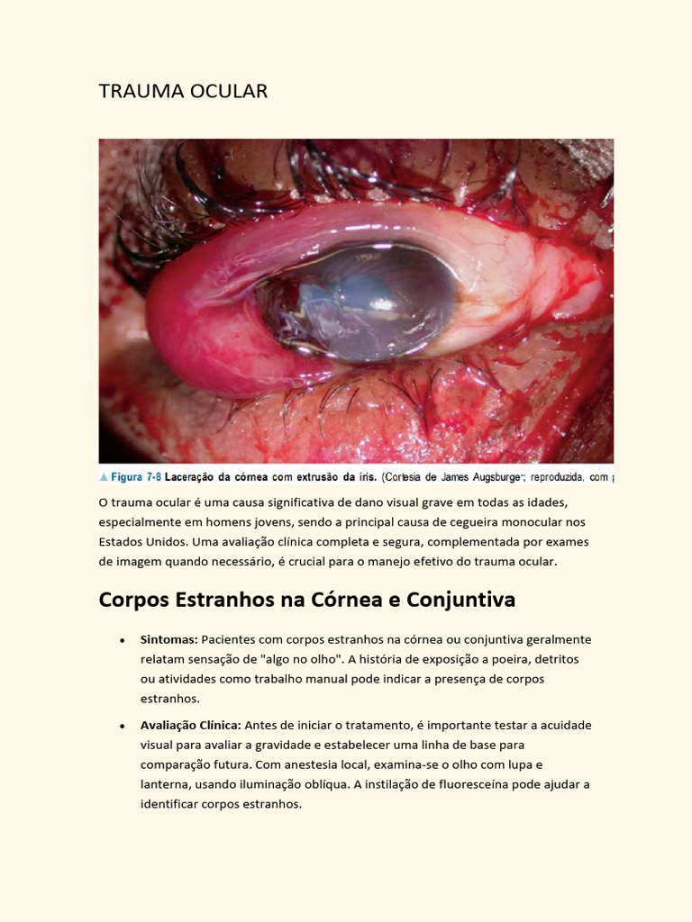 Trauma Ocular | PDF | Remédio | Medicina Clínica