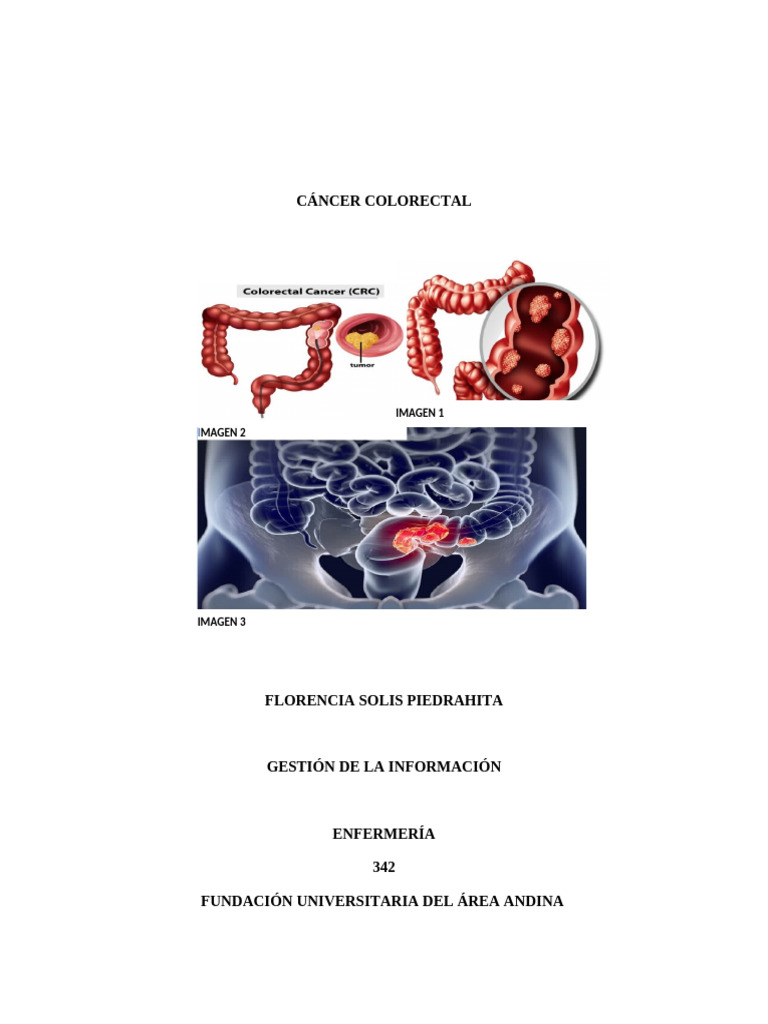 Cáncer Colorectal Apa | PDF