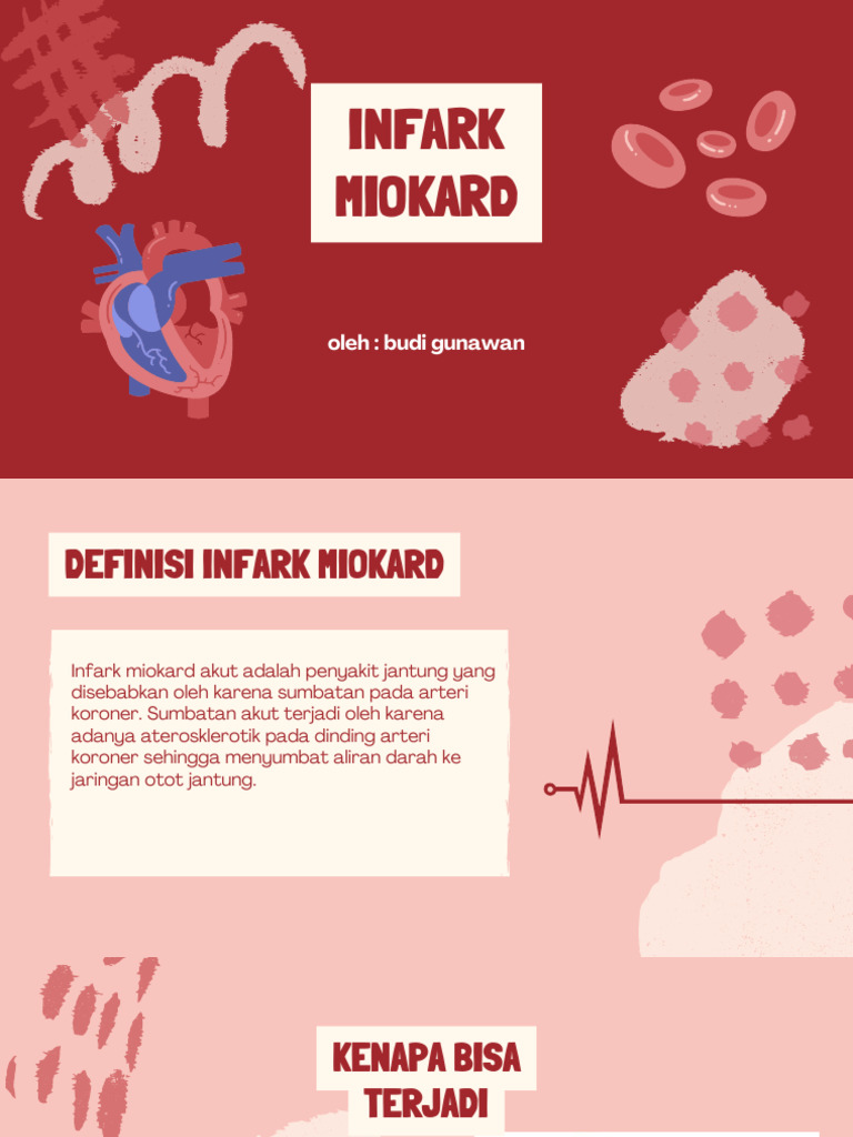 Infark Miokard - Bubu | PDF