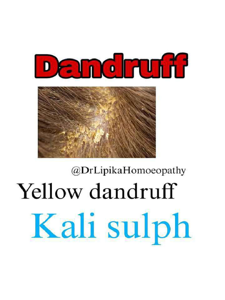 Dandruff | PDF