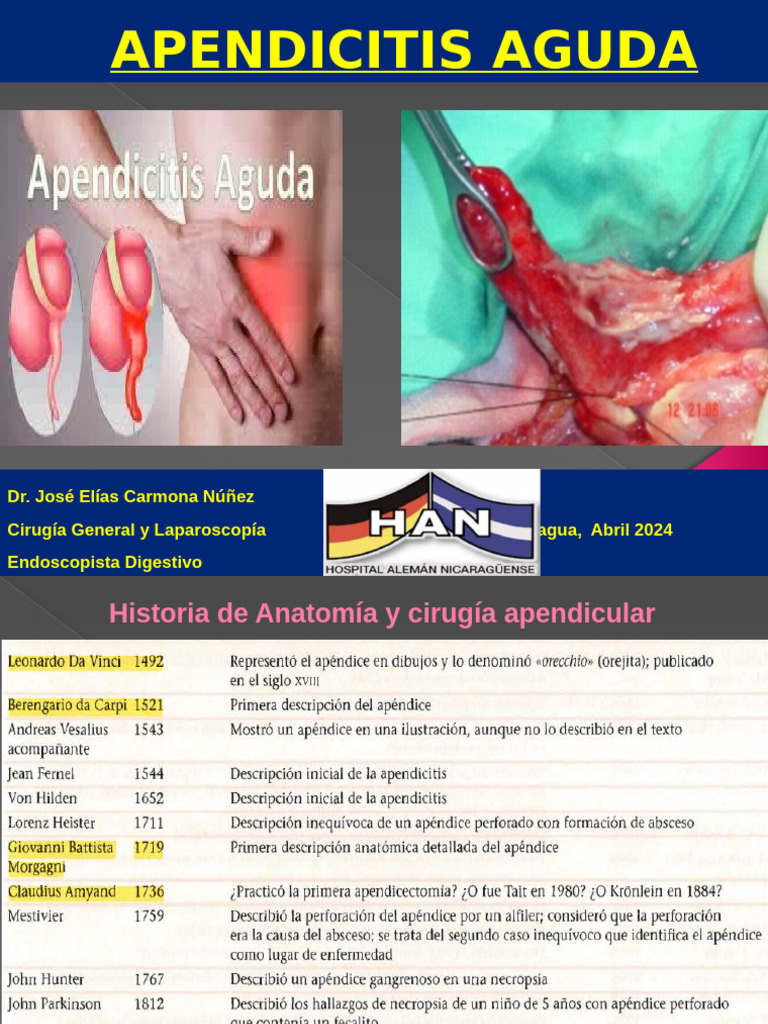 Apendicitis Aguda 2024 | PDF