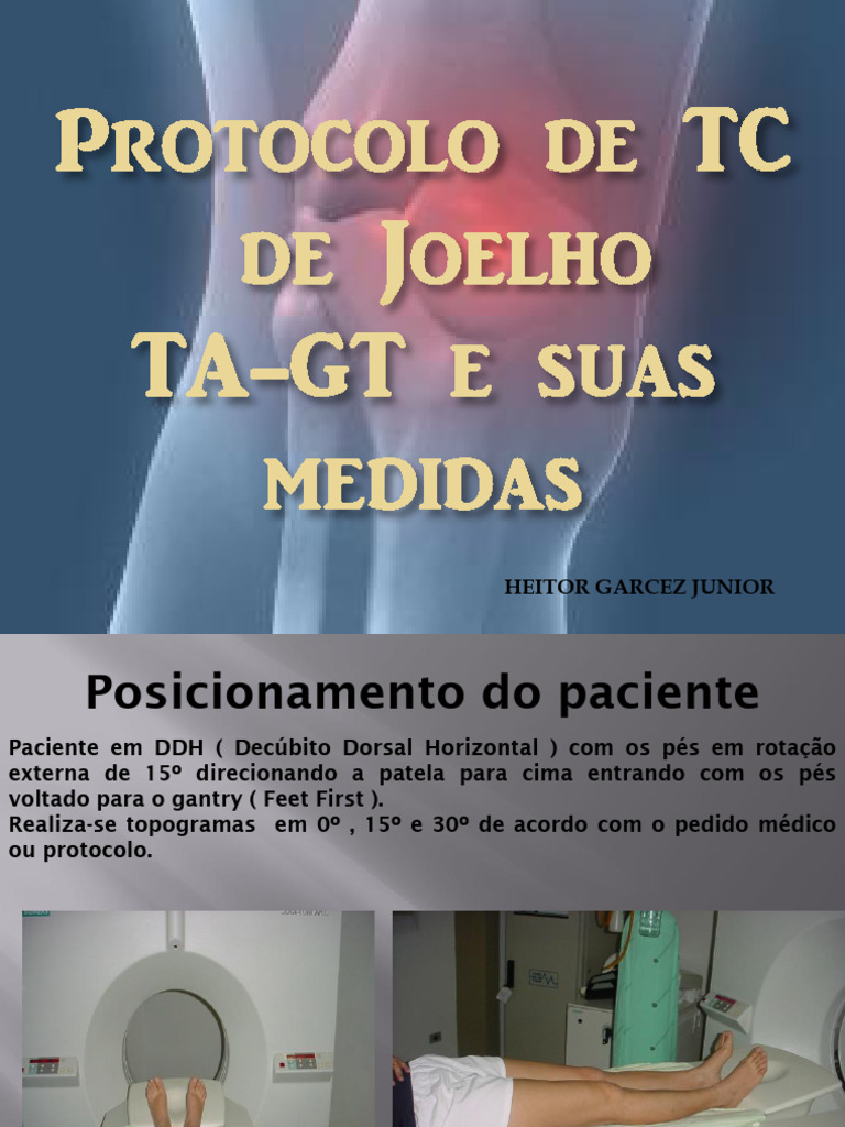 Ta GT | PDF