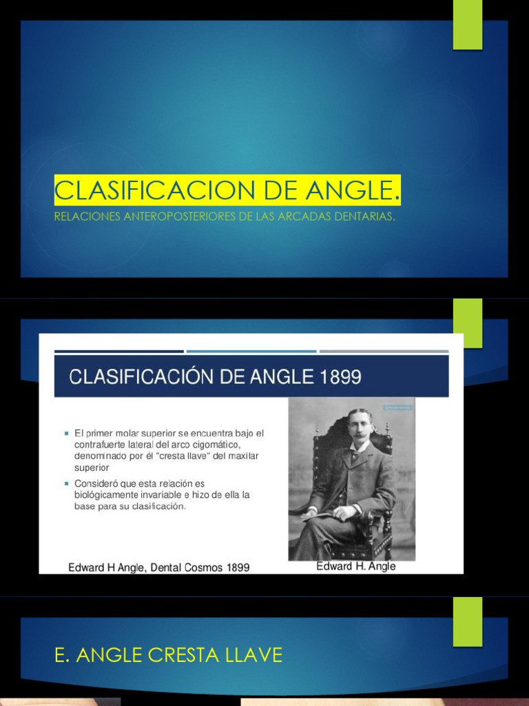 CLASIFICACIÓN DE ANGLE | PDF