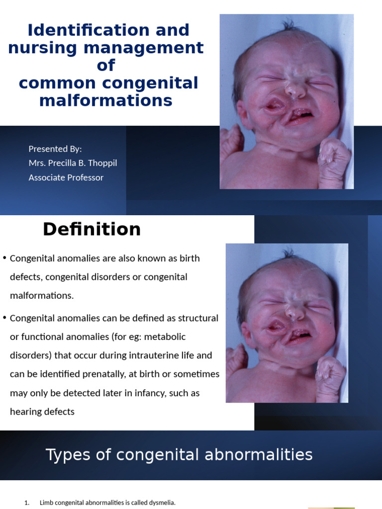 Identification and Nursing Management of Common Congenital ...