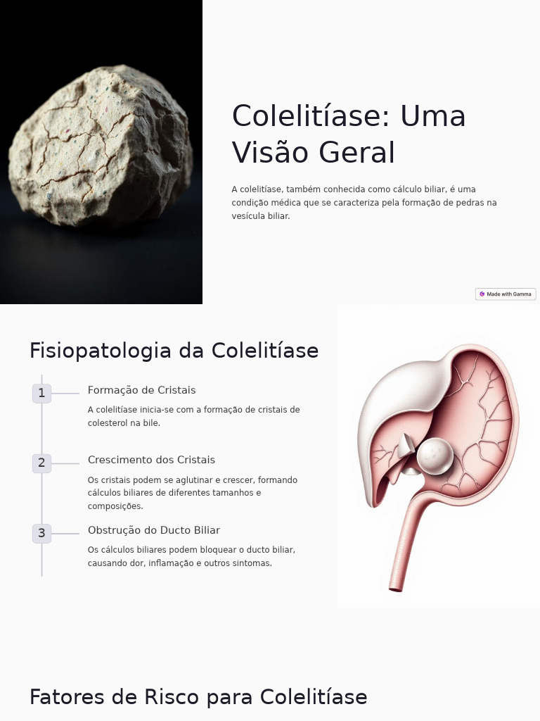 Colelitiase Uma Visao Geral | PDF