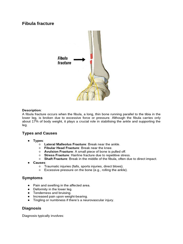 Fibula Fracture | PDF
