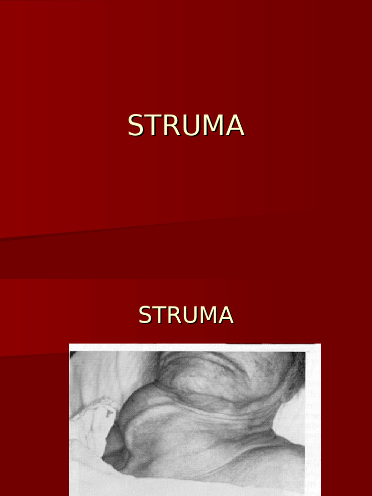 Struma Toksis Dan Non Toksis | PDF