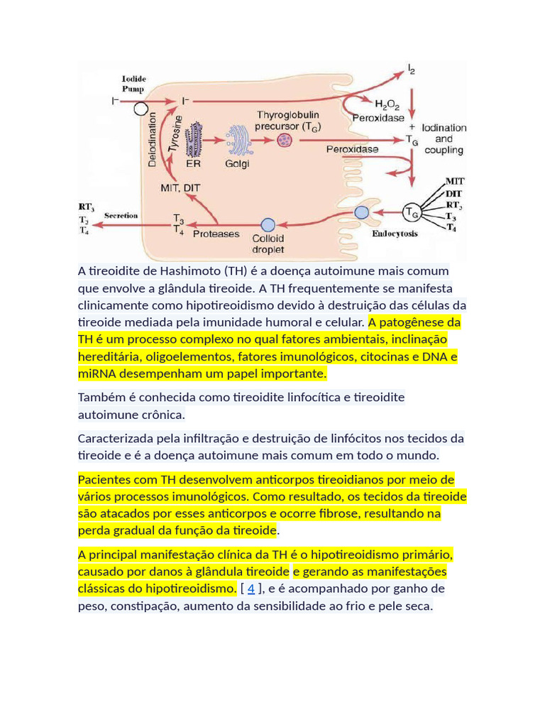 A Tireoidite de Hashimoto | PDF