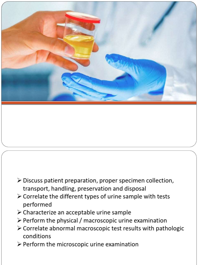 Routine Urinalysis Flow 1 1 | PDF