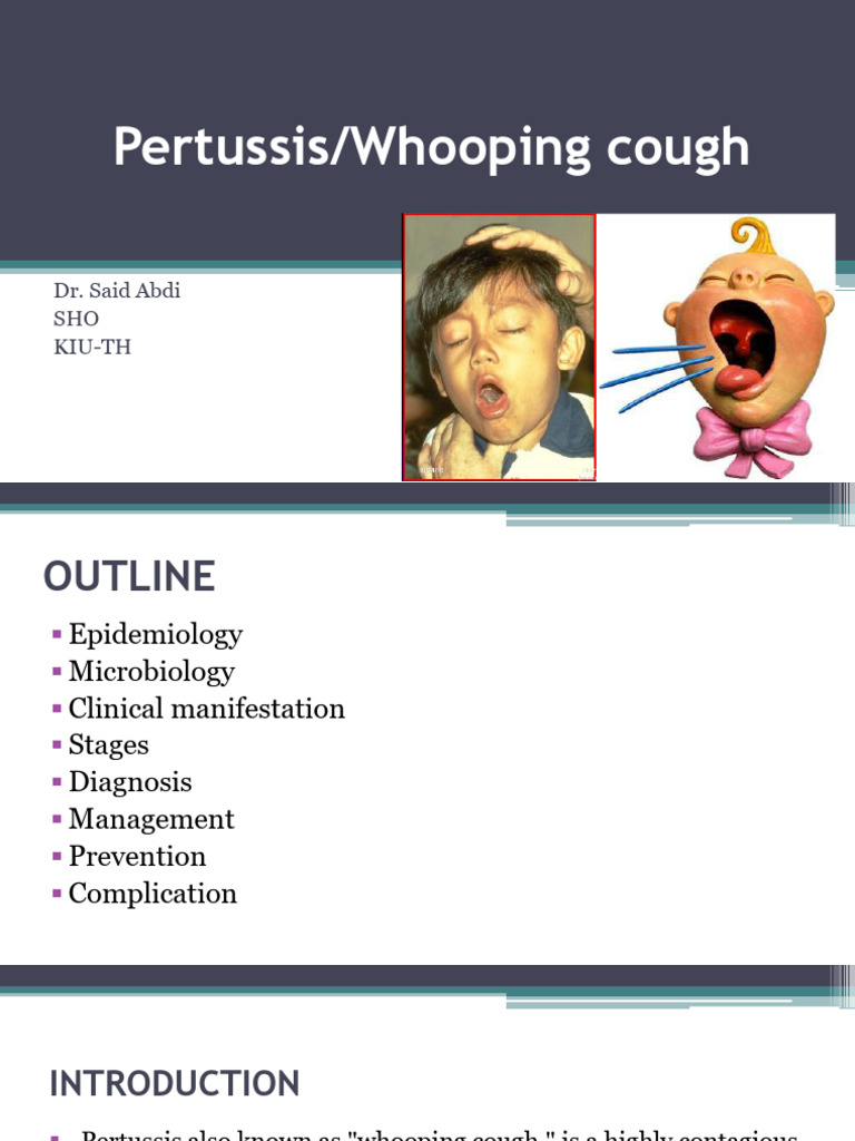 34 Pertussis | PDF