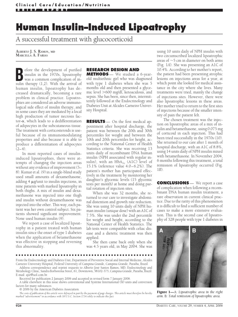 Lipoatrophy from Insulin | PDF
