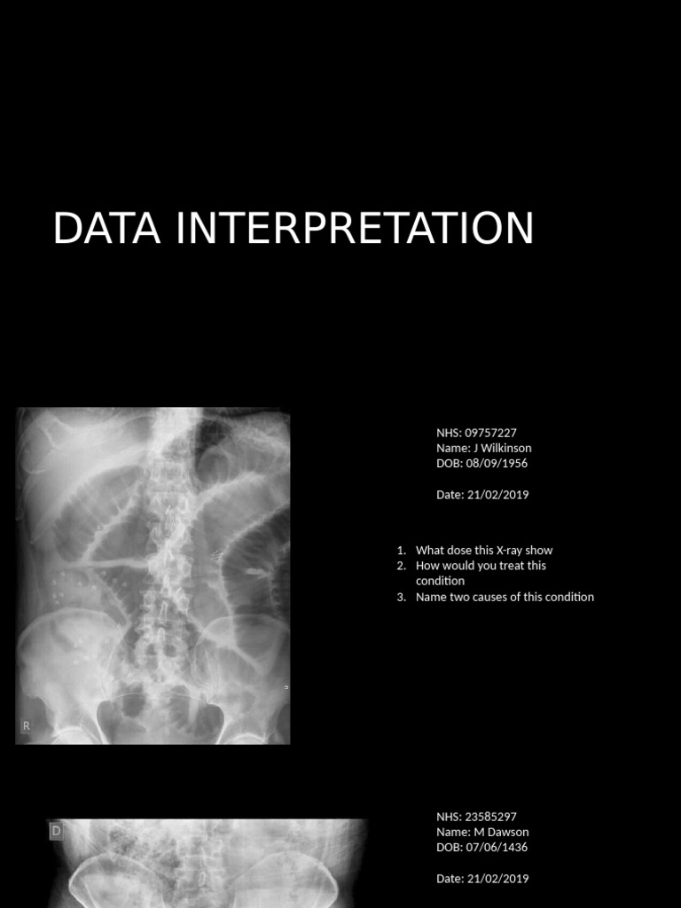 Data Interp 1 | PDF