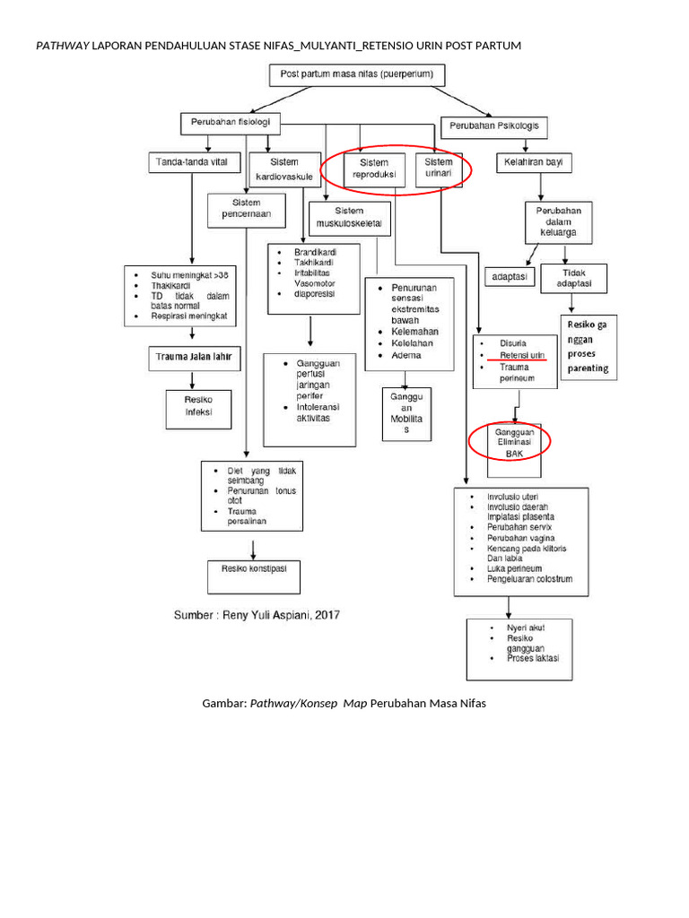 Gambar Pathway_Mind Map LP Yanti_Retensi urin Ms Nifas | PDF