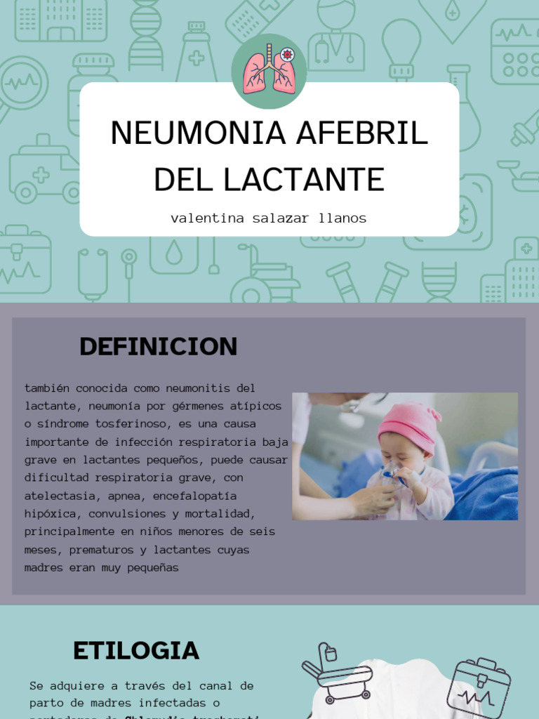 Neumonia Afebril | PDF