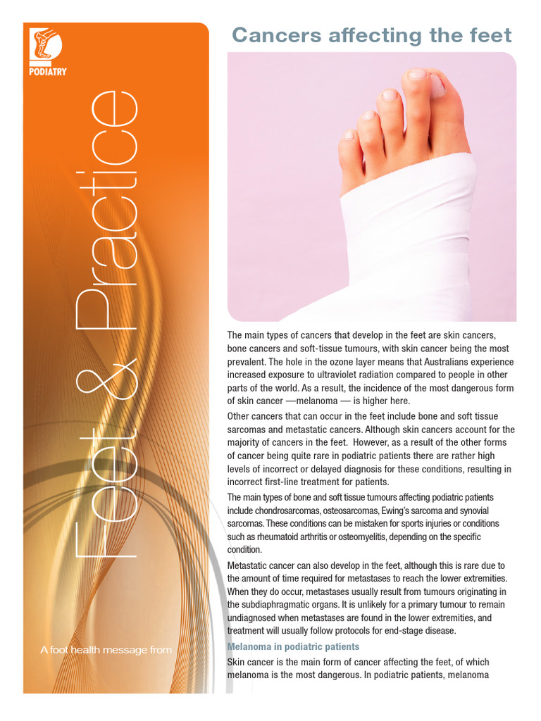 379-Cancers of The Feet 2 | PDF | Melanoma | Cancer
