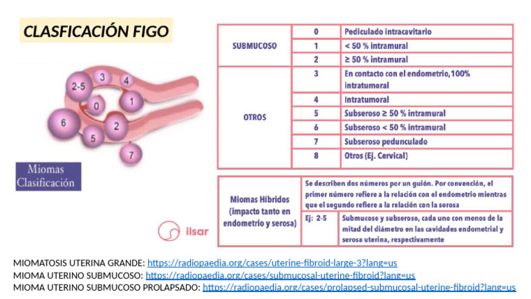 Mioma - Figo - Carlos Carrera Iman - Pre Internado c2p6 | PDF