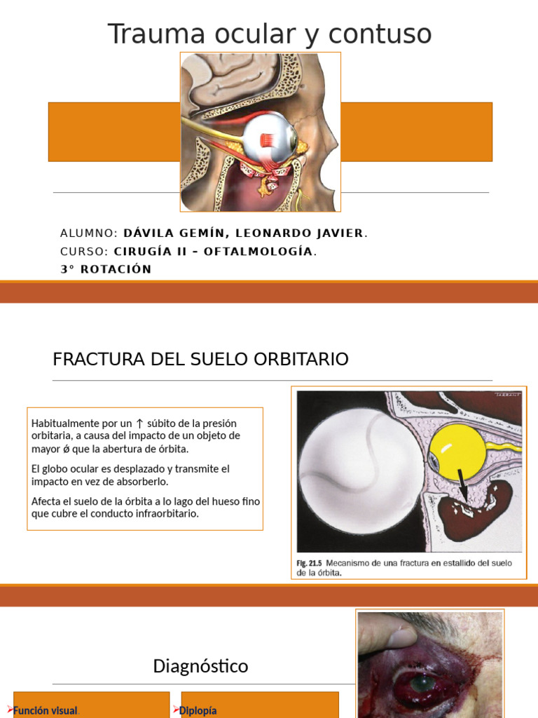 Trauma Ocular | PDF | Ojo humano | Percepción visual