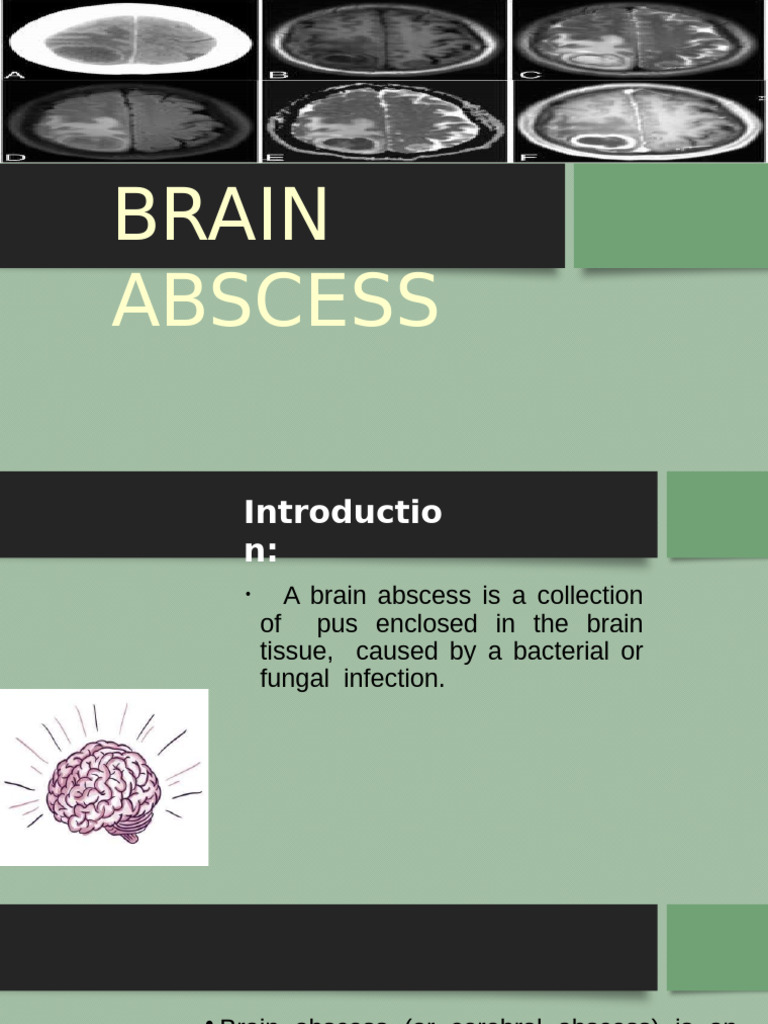 Brain Abscess | PDF