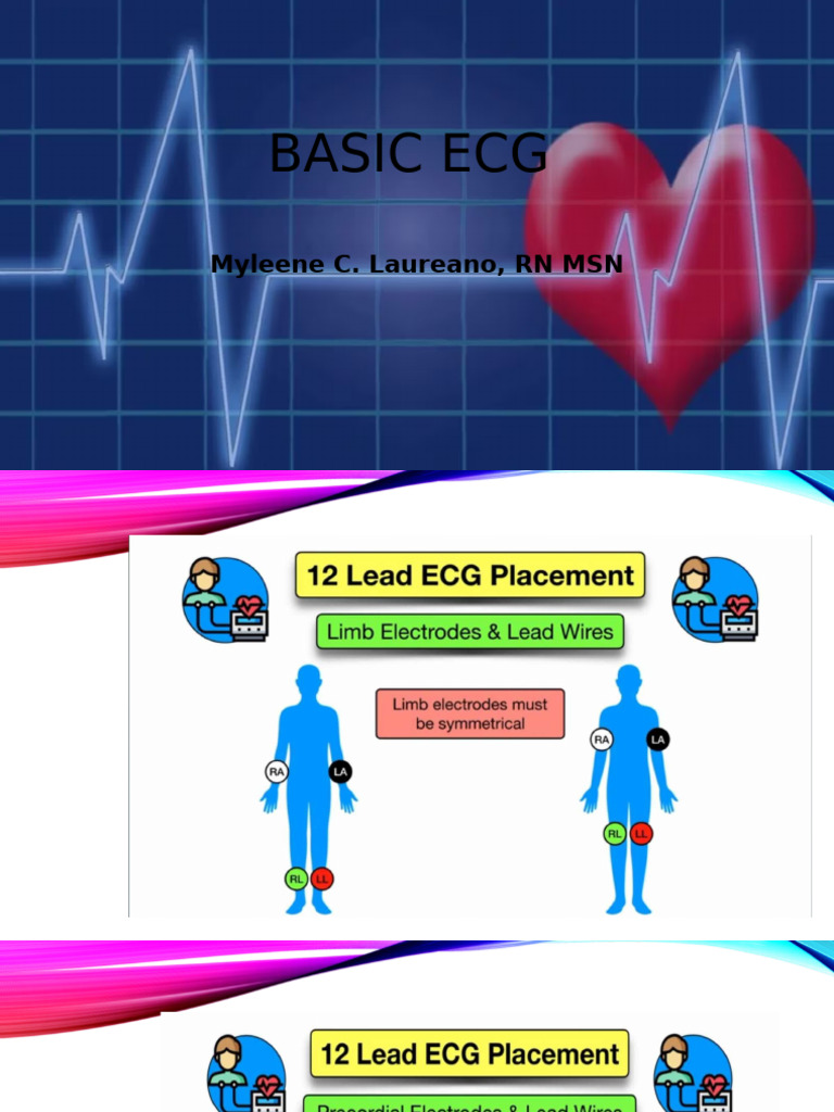 Basic - EGc | PDF