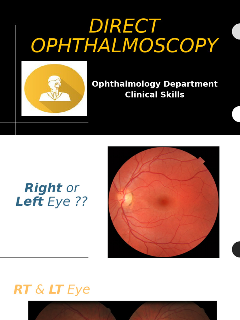 Direct Ophthalmos | PDF
