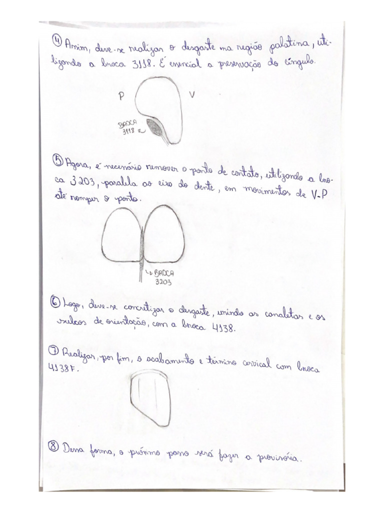 Ca 3203, Paralela Ao Eixo Do Dente, em Movimentos de V-P | PDF