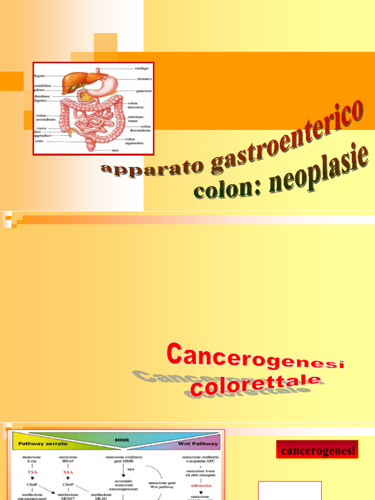 Colon - Neoplasie | PDF