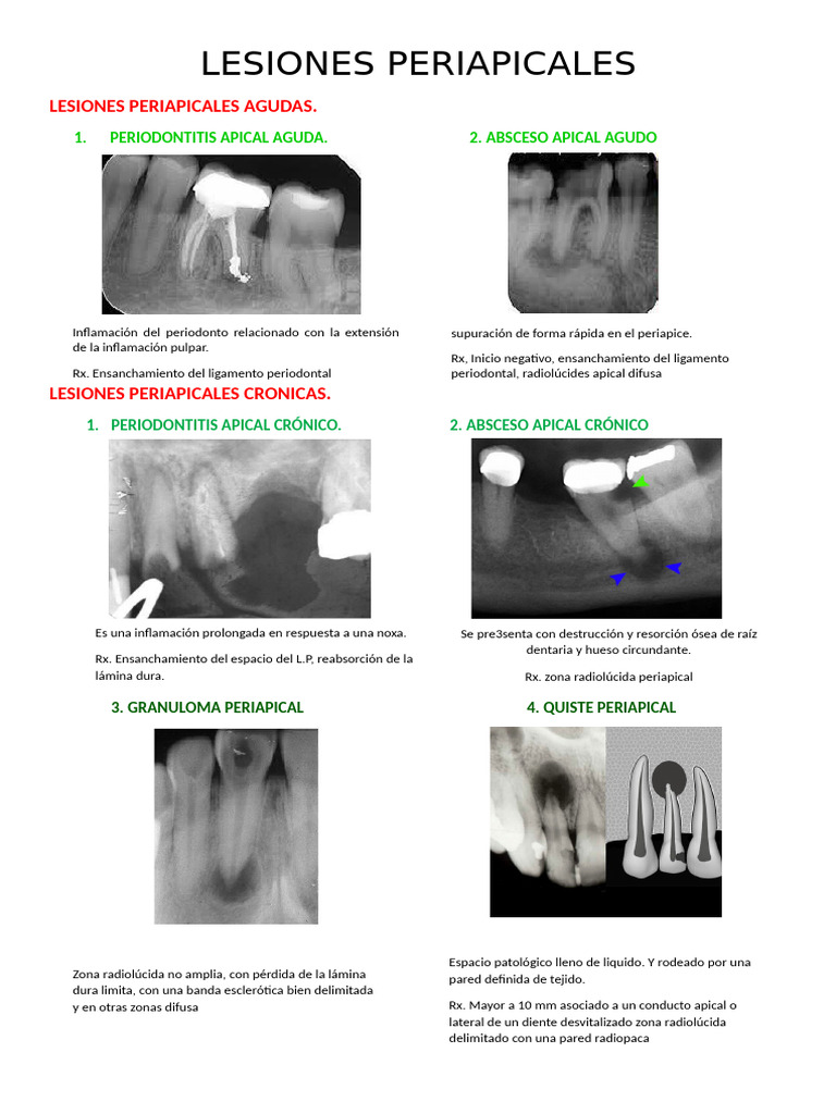 LESIONES PERIAPICALES | PDF