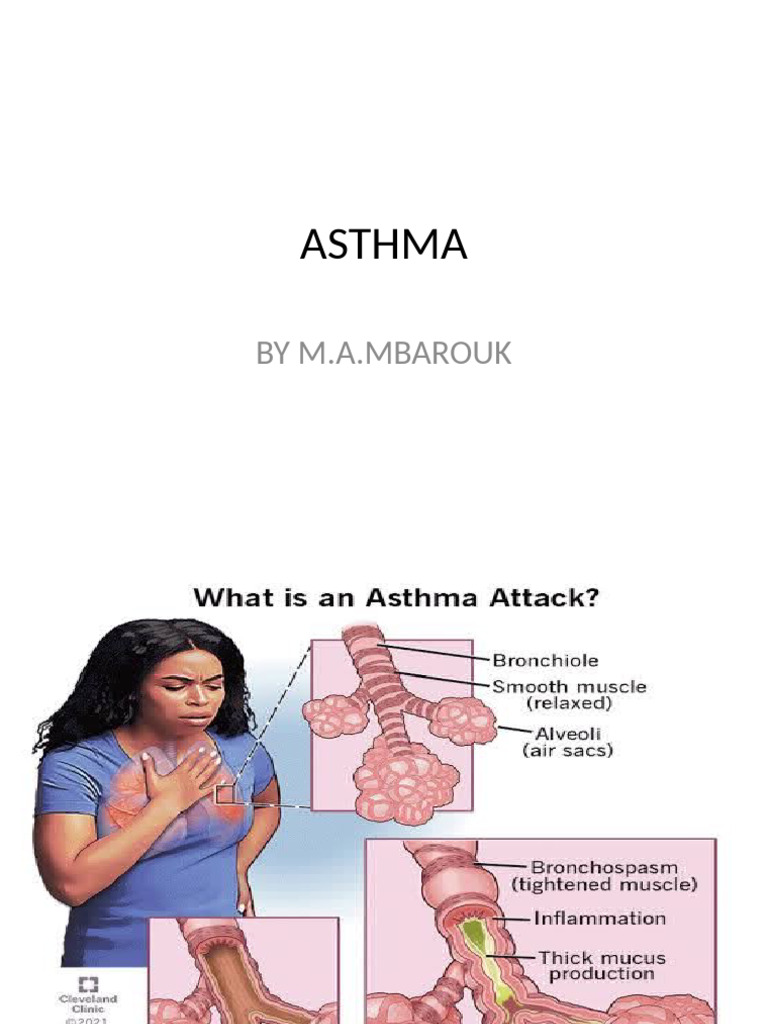 SESSION 12 ASTHMA | PDF
