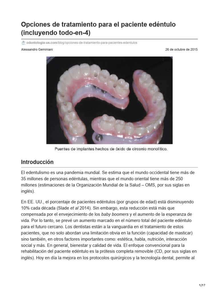 odontologia-us.com-Opciones de tratamiento para el paciente edÃ©ntulo ...
