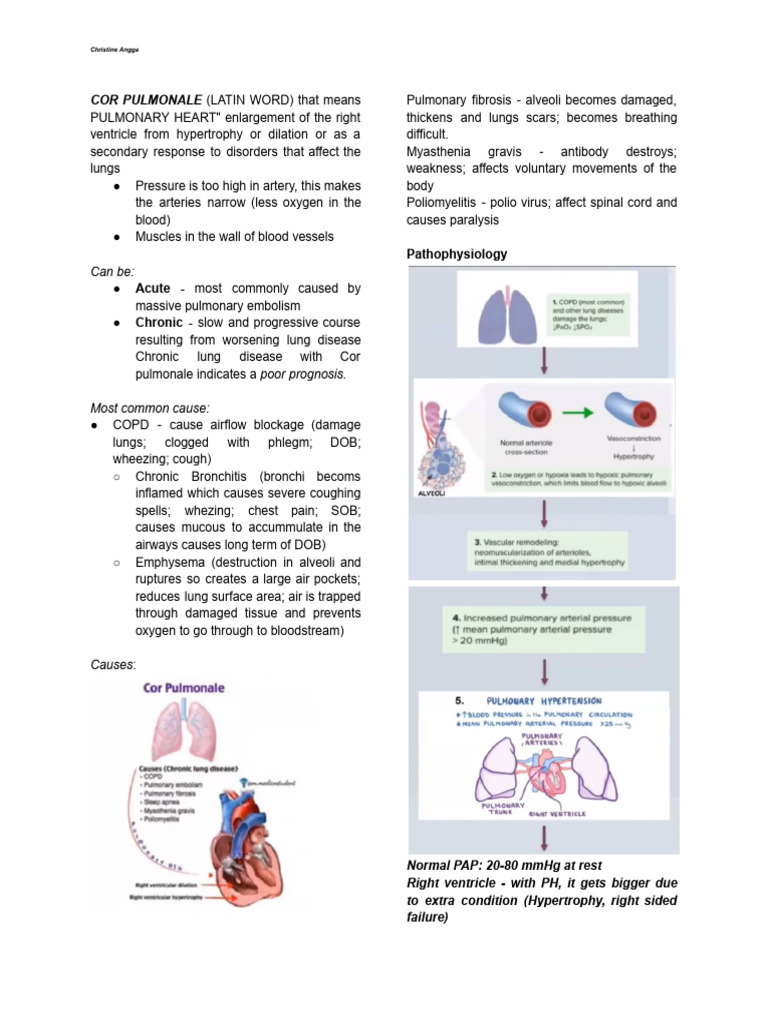 Cor Pulmonale | PDF