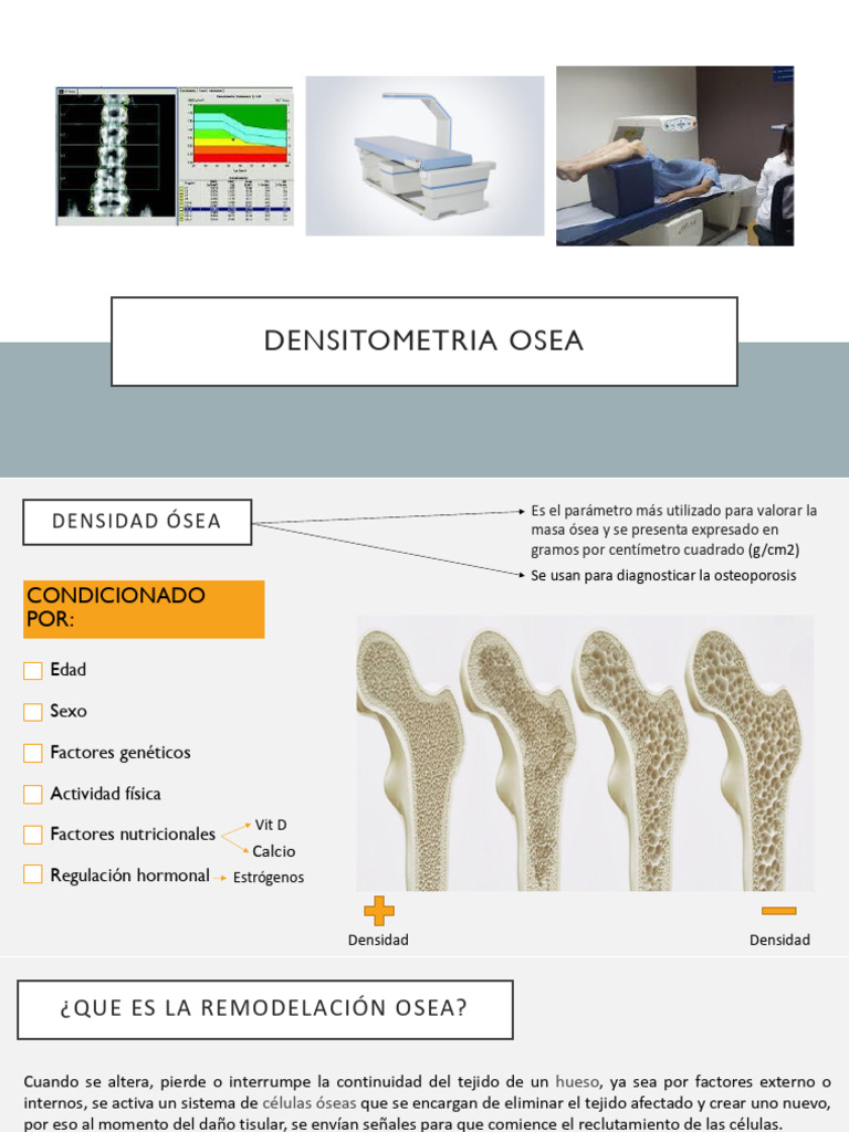 03 UD3 Densitometria Osea | PDF