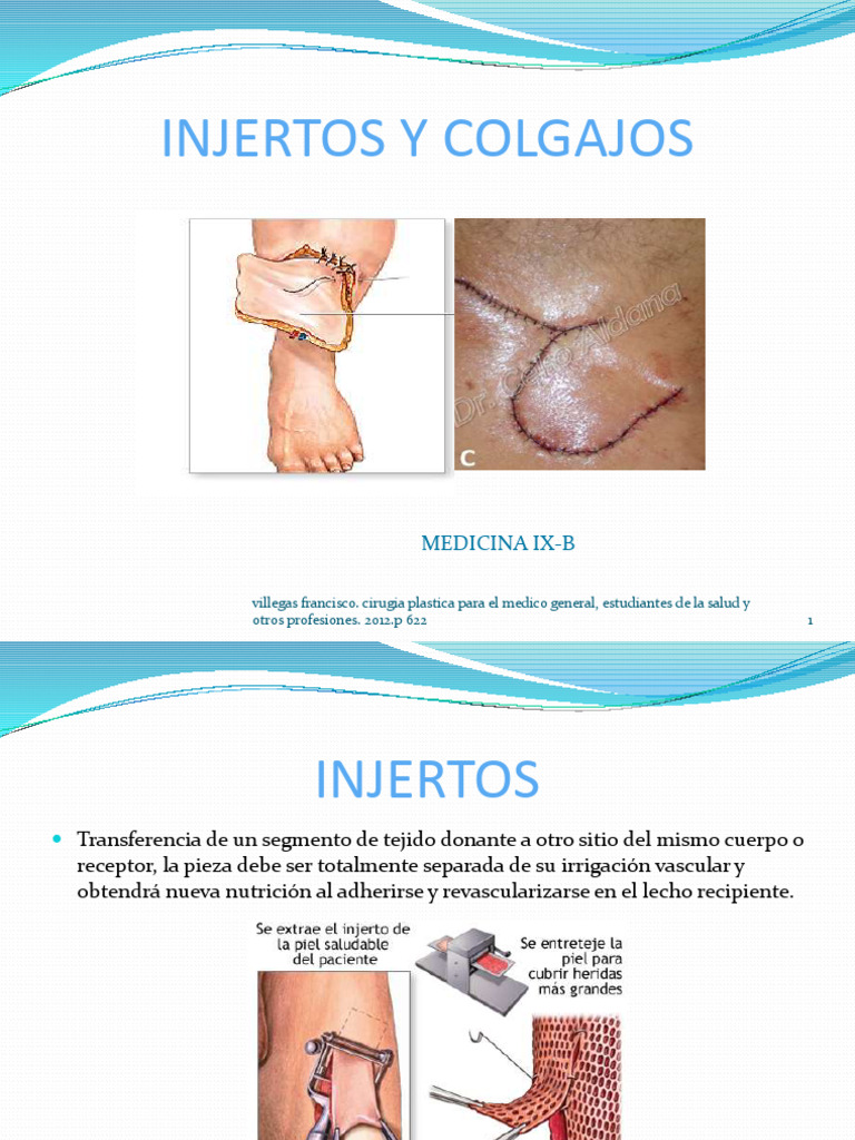 injertos-y-colgajos-cirugia-plastica-160223022653 | PDF