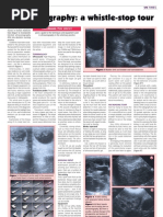 Sample Ultrasound Report | PDF | Adrenocorticotropic Hormone | Medical ...
