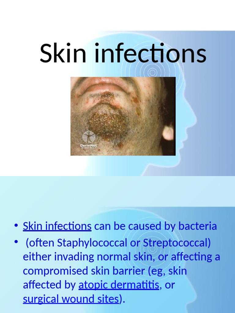 5 - Common Skin Infection 2017 | PDF