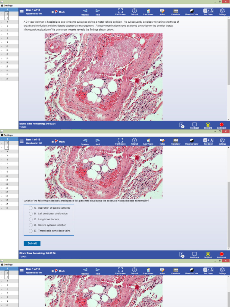 Patho Respiratory Block2 | PDF