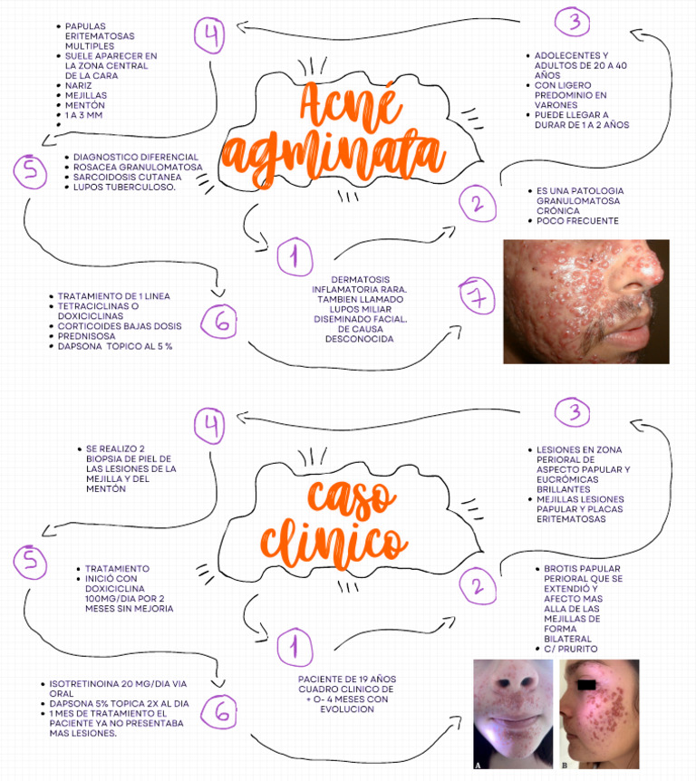 Mapa Mental de Controle Financeiro Simples Branco | PDF