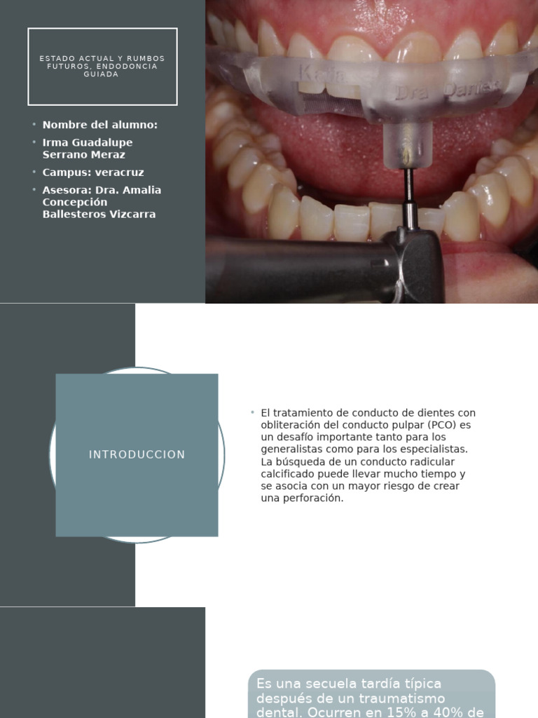Guia en Endodoncia Irma Guadalupe Serrano Meraz | PDF